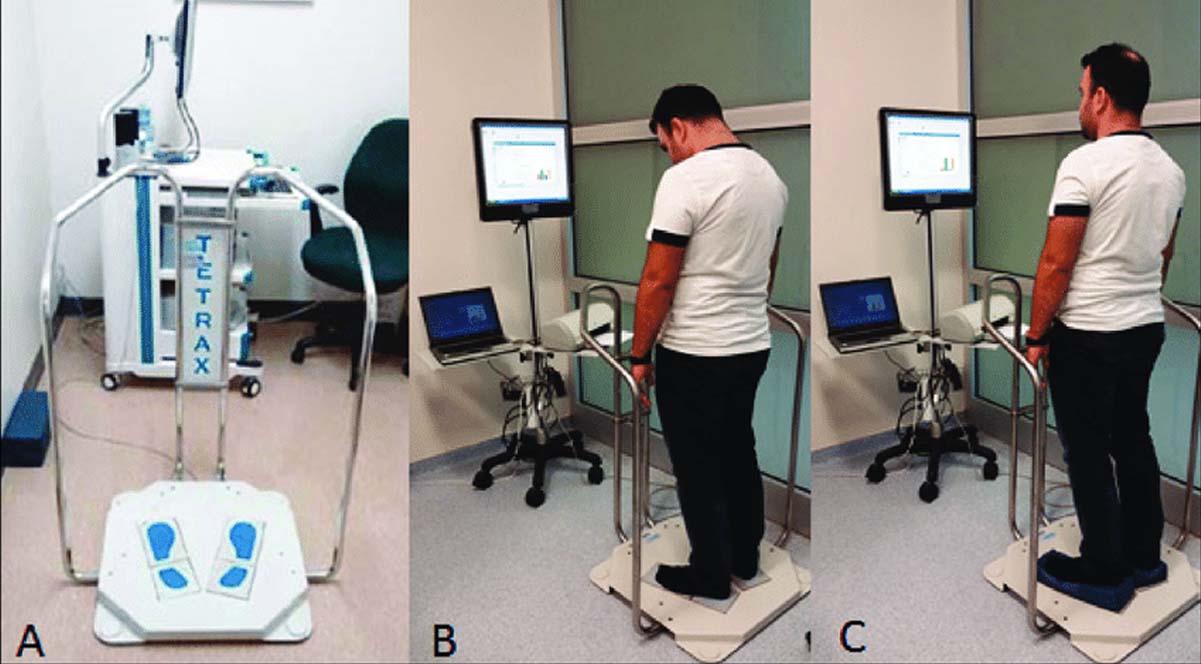 تست پوسچروگرافی (Posturography) چیست؟